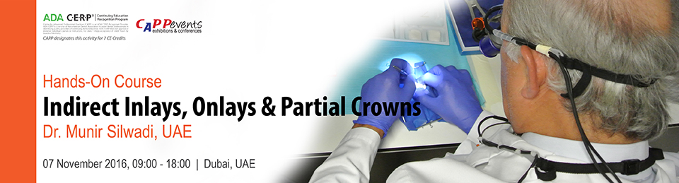 Indirect Inlays, Onlays & Partial Crowns by Dr. Munir Silwadi